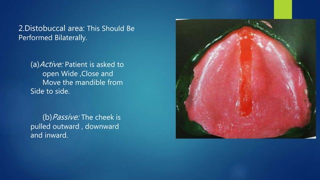 Border Moulding in Complete Denture Prosthesis | PPTX