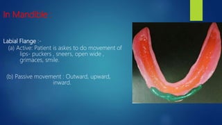 Border Moulding in Complete Denture Prosthesis | PPTX