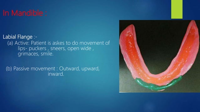 Border Moulding in Complete Denture Prosthesis | PPTX