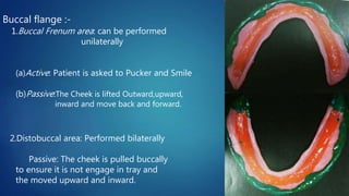 Border Moulding in Complete Denture Prosthesis | PPTX