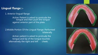 Border Moulding in Complete Denture Prosthesis | PPTX