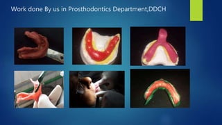 Border Moulding in Complete Denture Prosthesis | PPTX