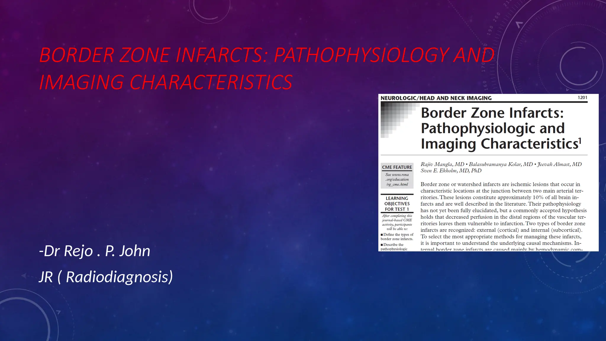 Border zone infarcts in cerebrum and cerebellum.pptx