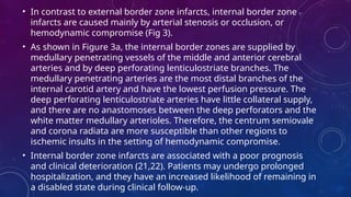 Border zone infarcts in cerebrum and cerebellum .pptx