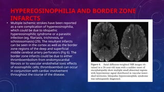 Border zone infarcts in cerebrum and cerebellum .pptx