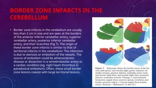 Border zone infarcts in cerebrum and cerebellum .pptx