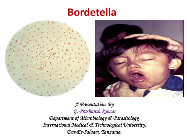 Bordetella | PPTX