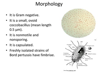 Bordetella | PPTX