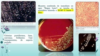 Bordetella | PPTX