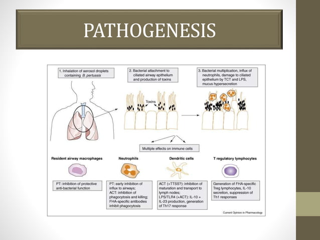 bordetella pertussis.................................ppt | Lung and ...