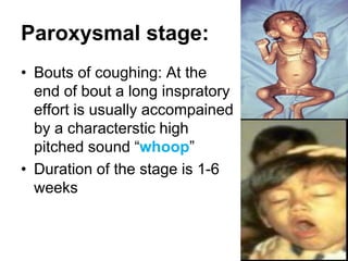 bordetella and brucella.ppt