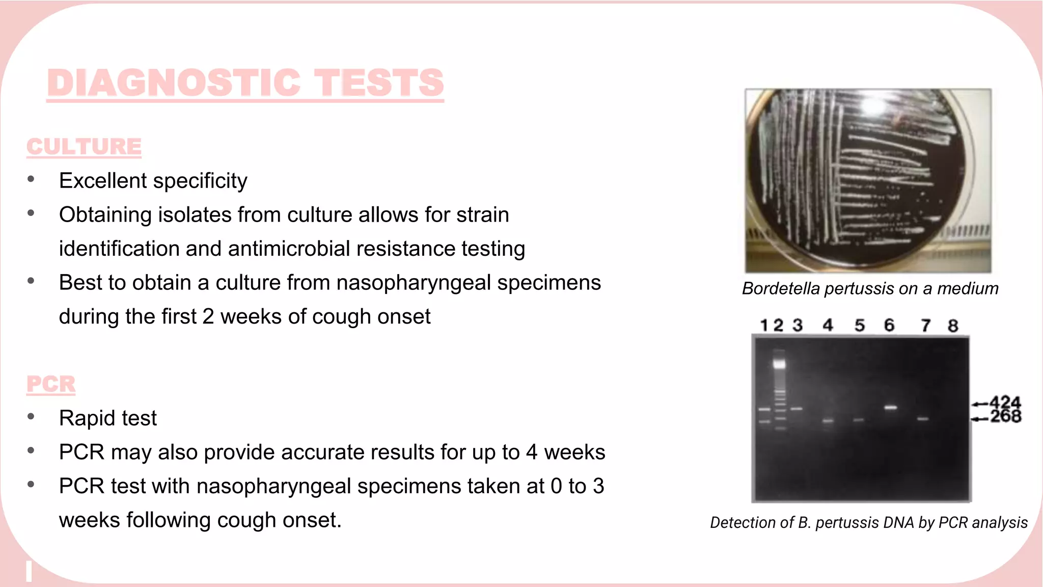 Bordetella pertussis | PPTX