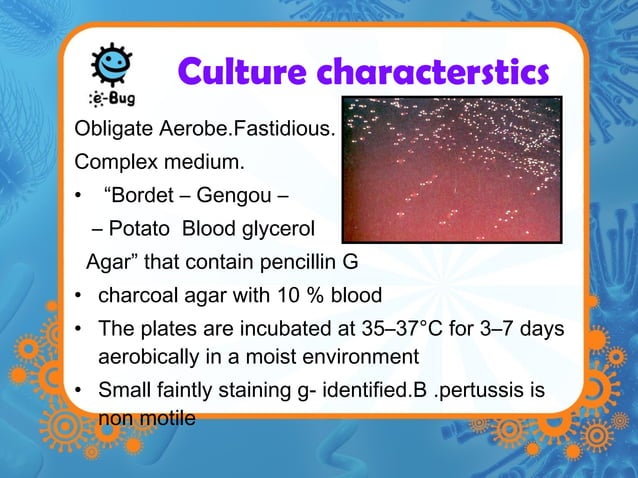 Bordetella pertussis by aslam matania | PPT