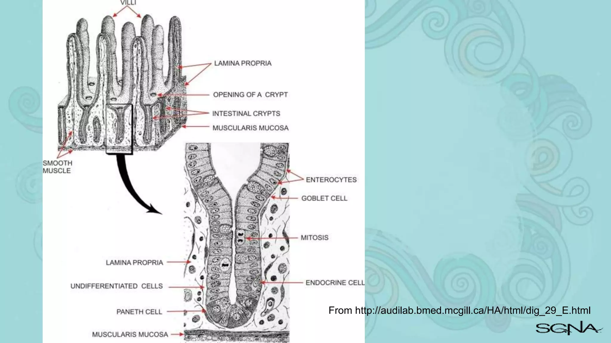 Bored with Barretts: Diagnosing Gastric Intestinal Metaplasia, Meckels ...