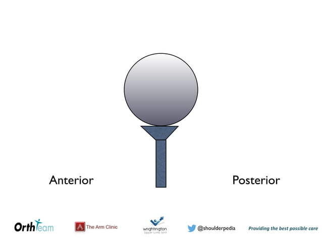 Atraumatic Shoulder Instability Principles and Assessment | PPT
