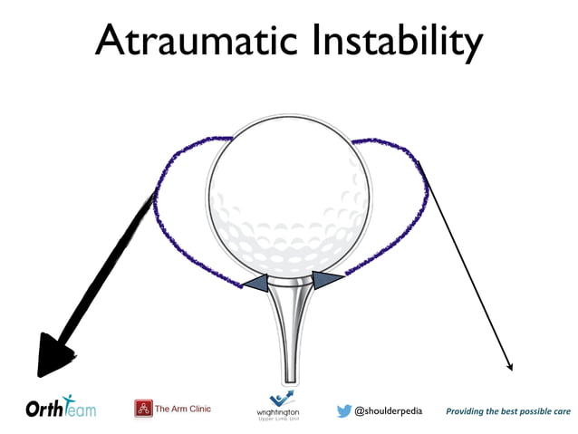 Atraumatic Shoulder Instability Principles and Assessment | PPT