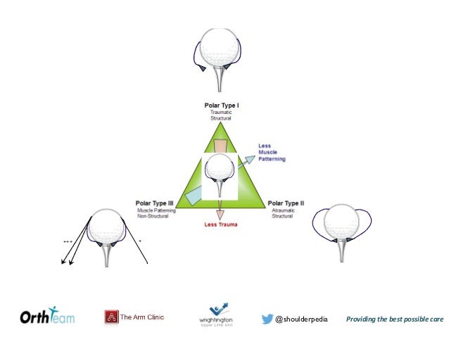 Atraumatic Shoulder Instability Principles and Assessment
