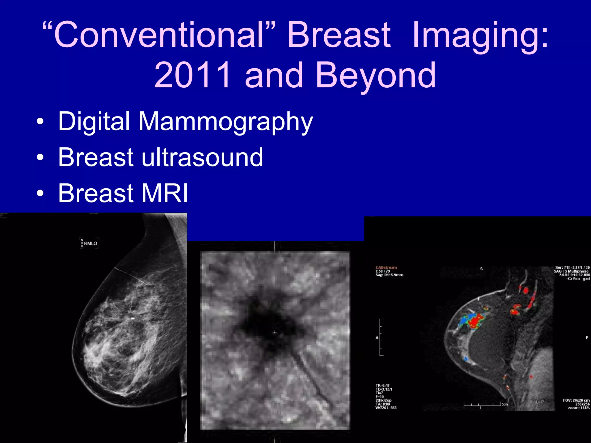 Evolving Trends in Breast MRI | PPT