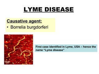 Borrelia | PPT