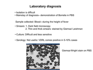 Borrelia,leptospira.ppt