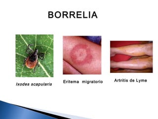 Borrelia y treponema | PPT