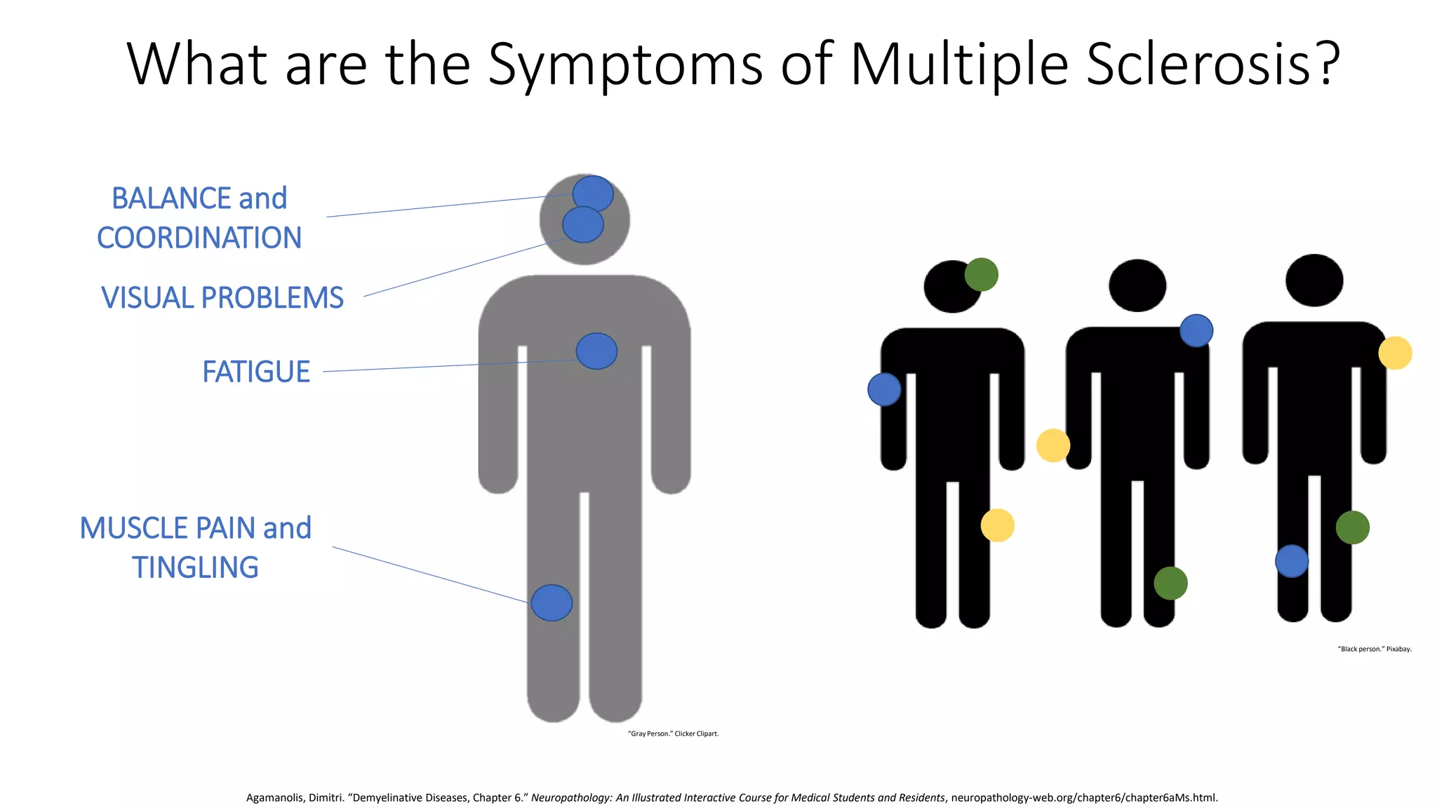 Borthwick_Multiple-Sclerosis (1).pptx