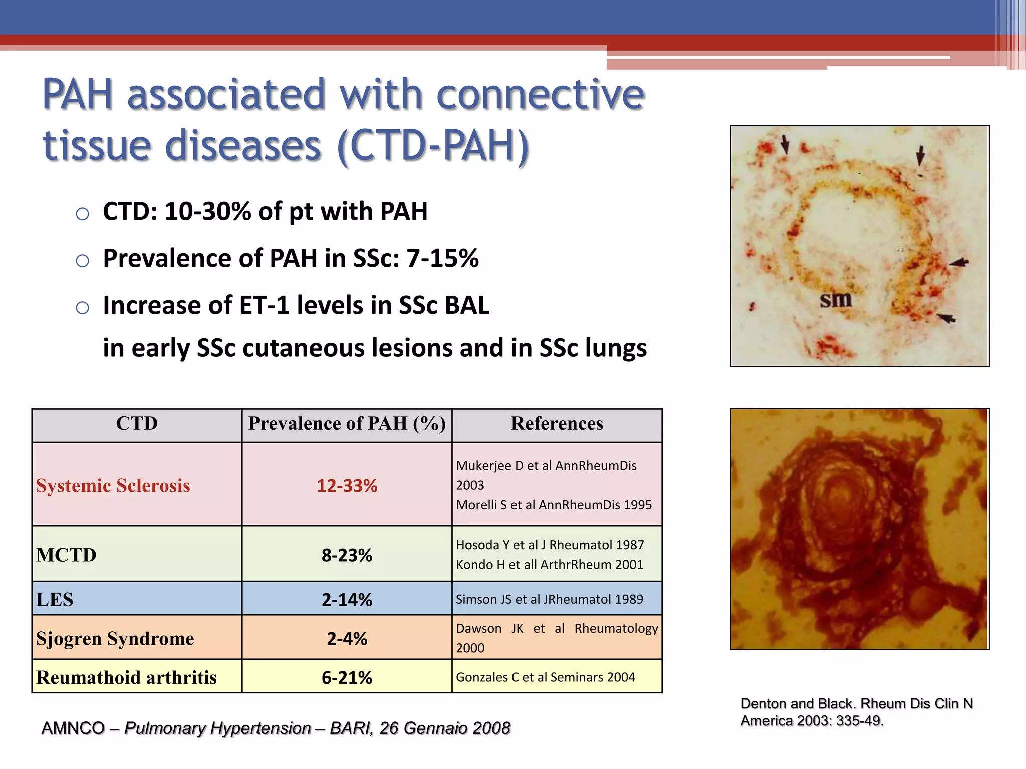 Bosentan in SSc-PAH 2014 | PPTX