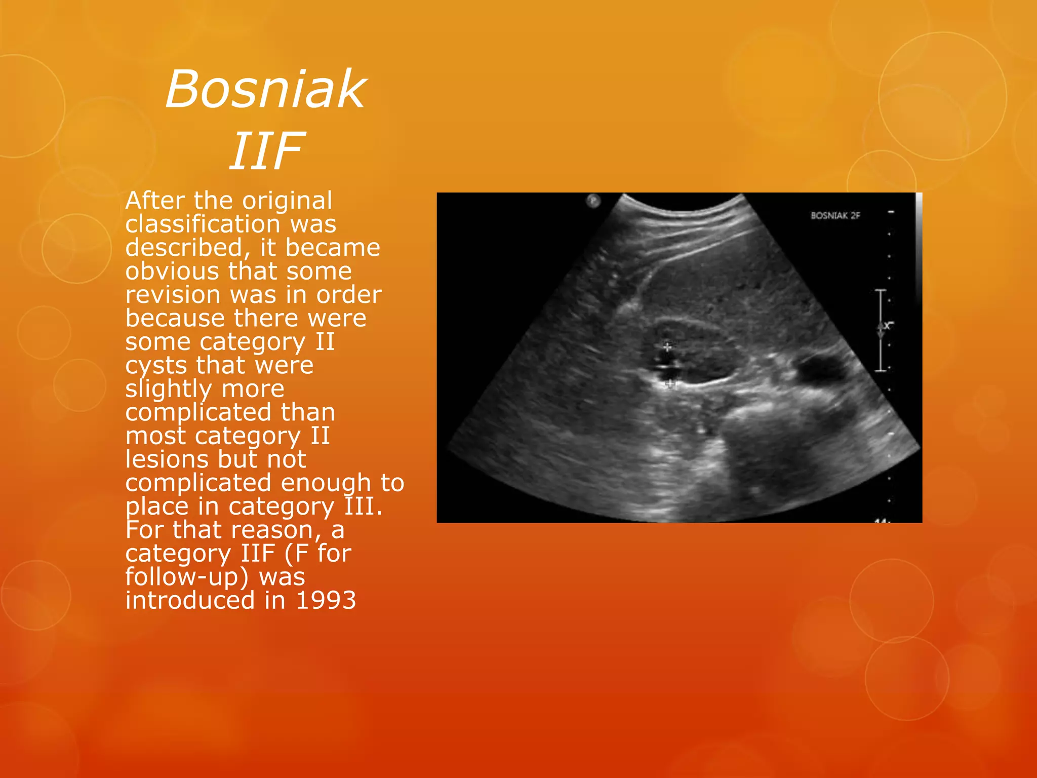 Bosniak Classification & Renal Cystic Disease | PPTX