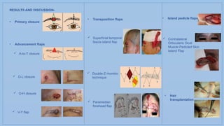 EYE-BROW RECONSTRUCTION -TECHNIQUES.pptx