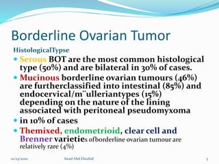 Border line ovarian Tumor | PPTX
