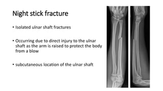both bone fractures of forearm Monteggia & Galeazzi.pptx