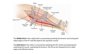 both bone fractures of forearm Monteggia & Galeazzi.pptx