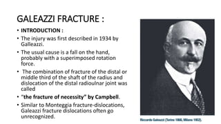 both bone fractures of forearm Monteggia & Galeazzi.pptx