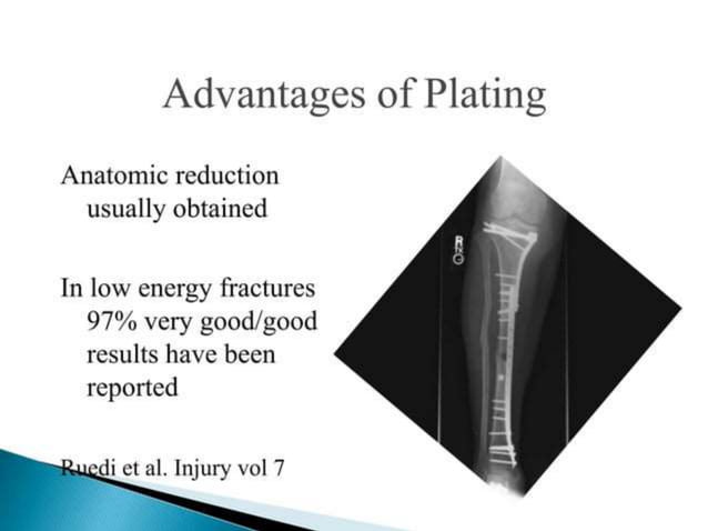 BOTH BONE LEG.ORTHOPEDICS,POWERPOINTpptx | PPTX | Bone and Joint ...