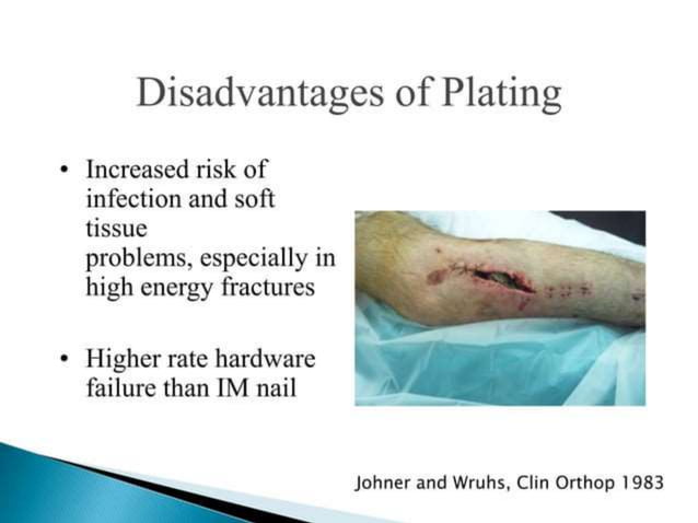 BOTH BONE LEG.ORTHOPEDICS,POWERPOINTpptx | PPTX | Bone and Joint ...