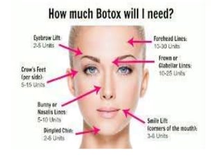 Botox.pptx