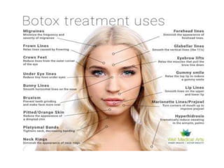Botox.pptx