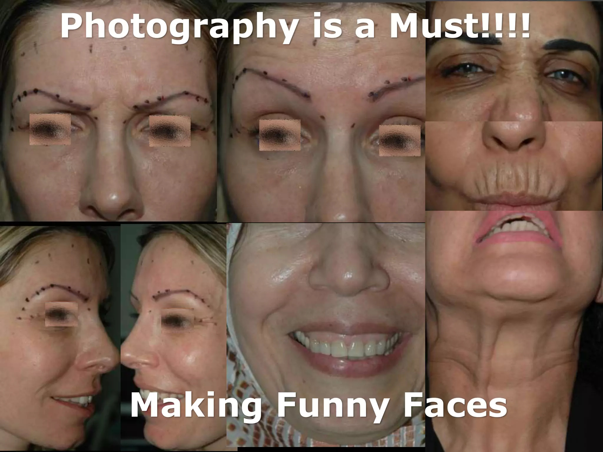 The Art of Liquid Face Lift (Botox) | PPSX