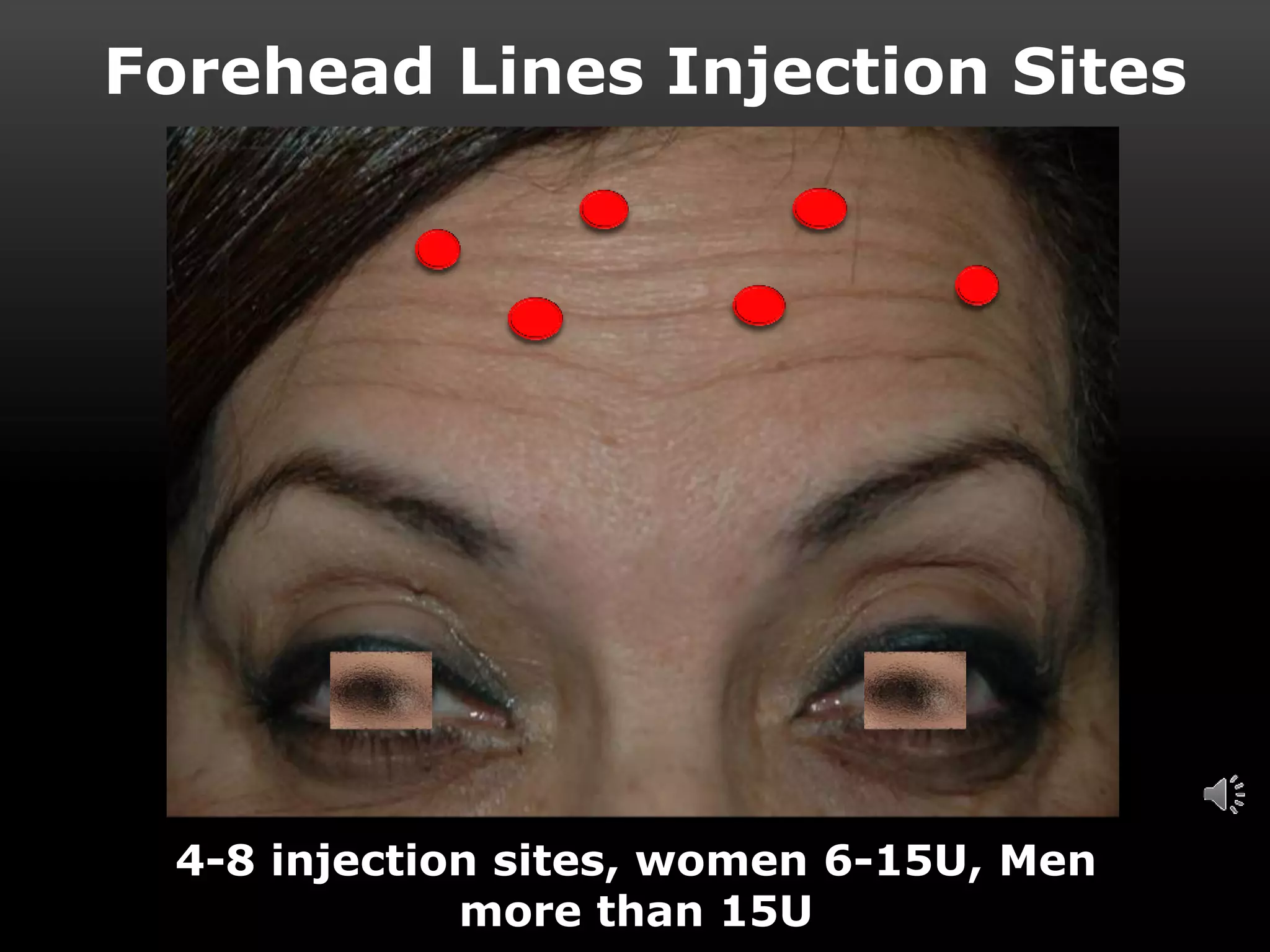 The Art of Liquid Face Lift (Botox) | PPSX | Skin Care | Beauty