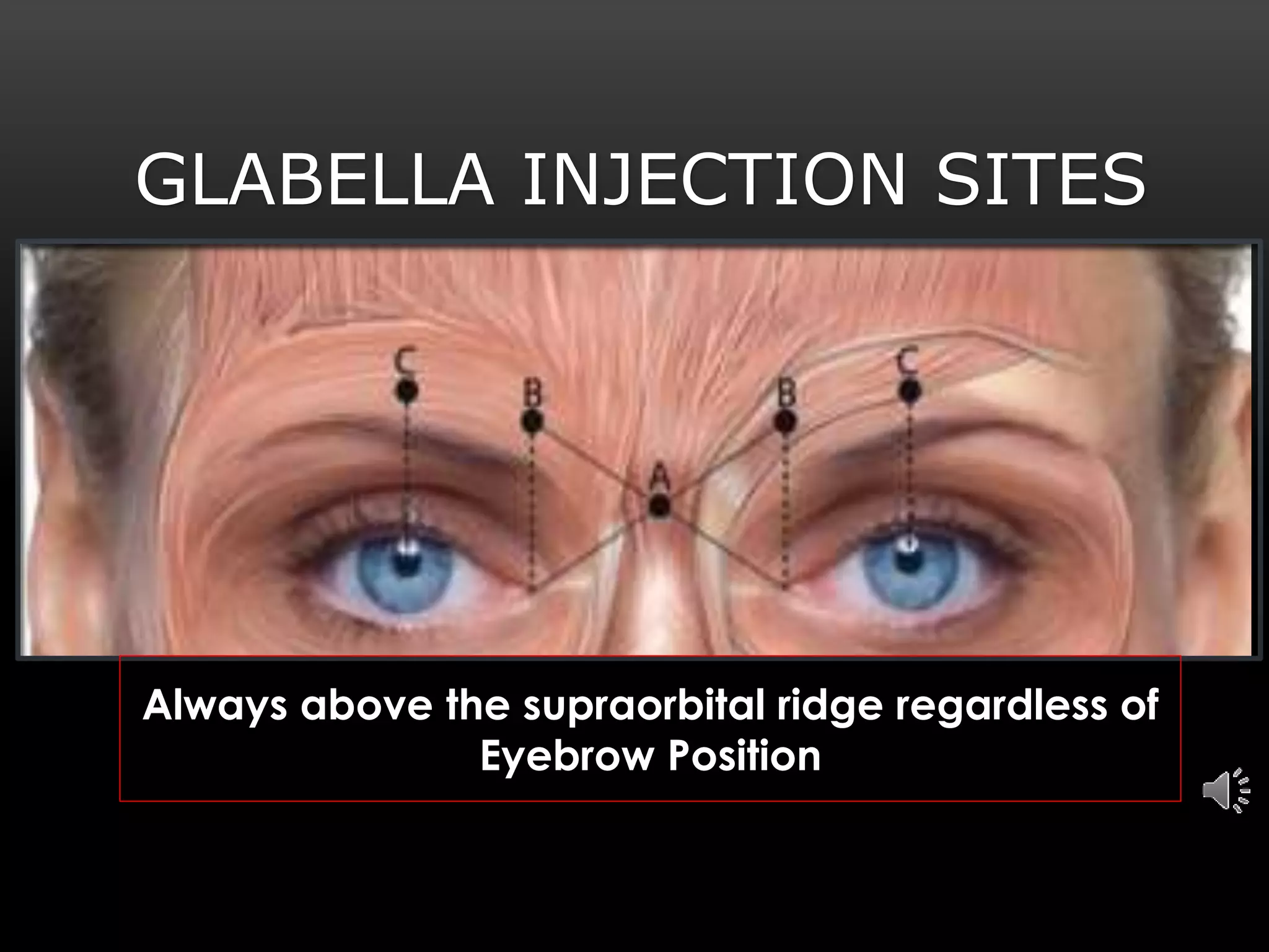 The Art of Liquid Face Lift (Botox) | PPSX