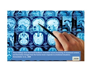 Botox and its effect on the Brain | PDF | Brain and Nervous System ...