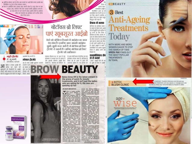 Botox case study | PPTX | Cosmetic Medical Services | Medical Health