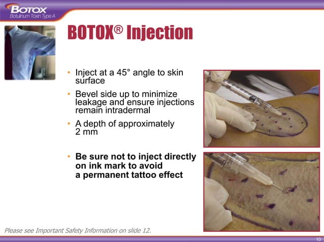 botox en enfermedad de hiperhidrosis axilar.ppt | Free Download