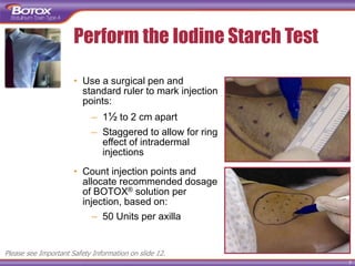 botox en enfermedad de hiperhidrosis axilar.ppt
