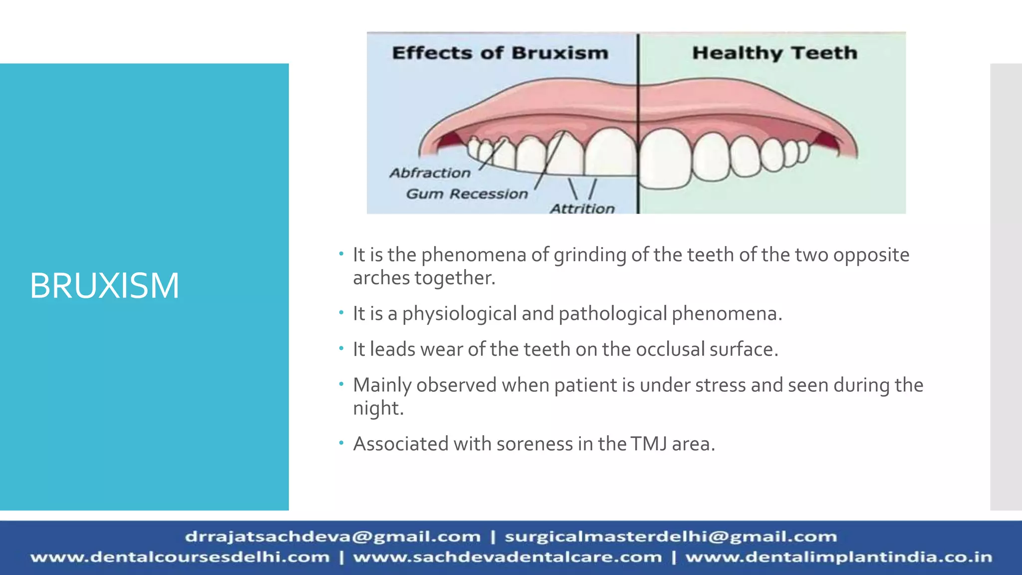 Botox for your TMJ (tempero mandibular joint) by Dr.Rajat Sachdeva ...