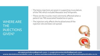 Botox for your TMJ (tempero mandibular joint) by Dr.Rajat Sachdeva ...