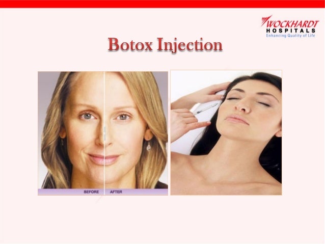 Botox Injection