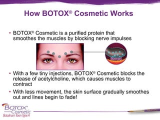 Botox Presentation for Patients | PPT