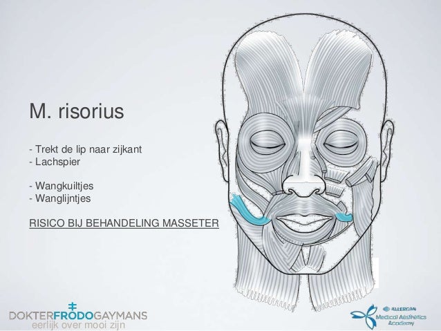 Botox training dokter frodo gaymans