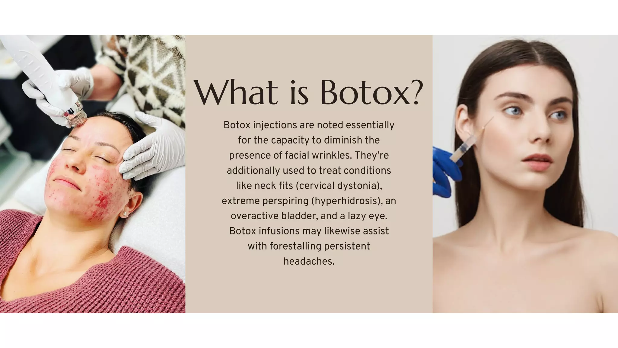 Botox Treatment | PPT